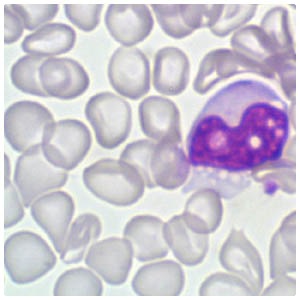 Como não confundir um monócito com um linfócito? | Biomedicina Padrão